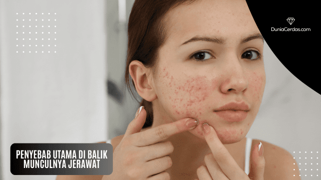 Jerawat di Dahi: Penyebab, Ciri, dan Cara Mengatasinya - Dunia Cerdas