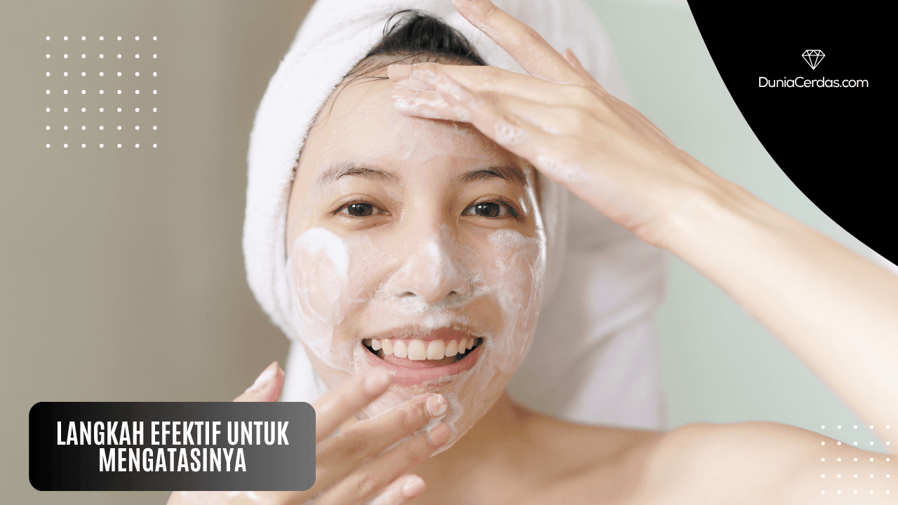 Jerawat di Dahi: Penyebab, Ciri, dan Cara Mengatasinya - Dunia Cerdas